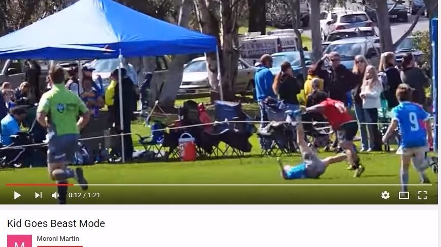 Should this young rugby player be playing youth sports? | 12news.com